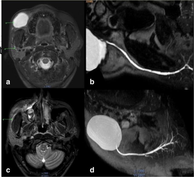 בדיקות חדשות בעזרת סורק ה-MRI | חדשות המדע
